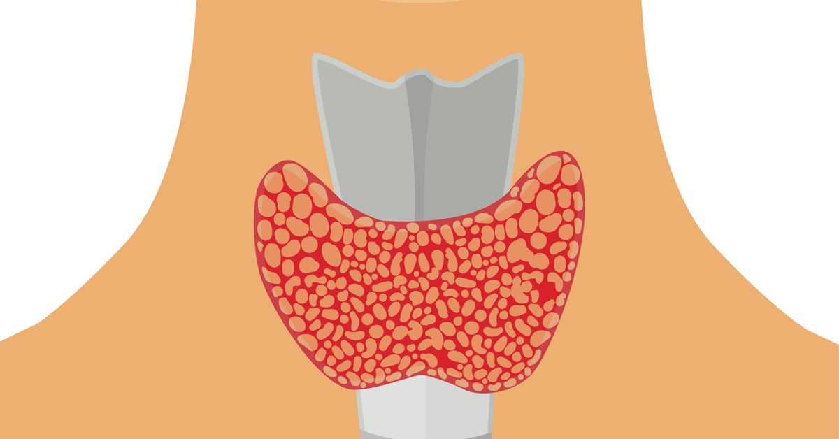 Automatisk etterbestilling av frie tyreoideahormoner ved unormal TSH ...